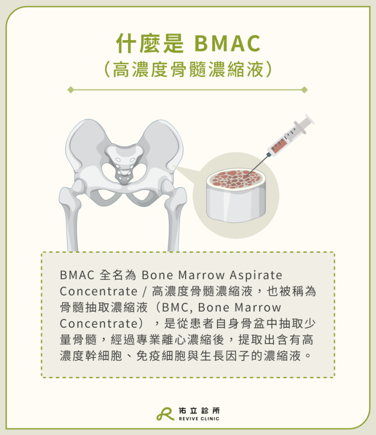 BMAC治療指南：與PRP差異、適用症、流程與治療後照護總覽 - 佑立診所 Revive Clinic