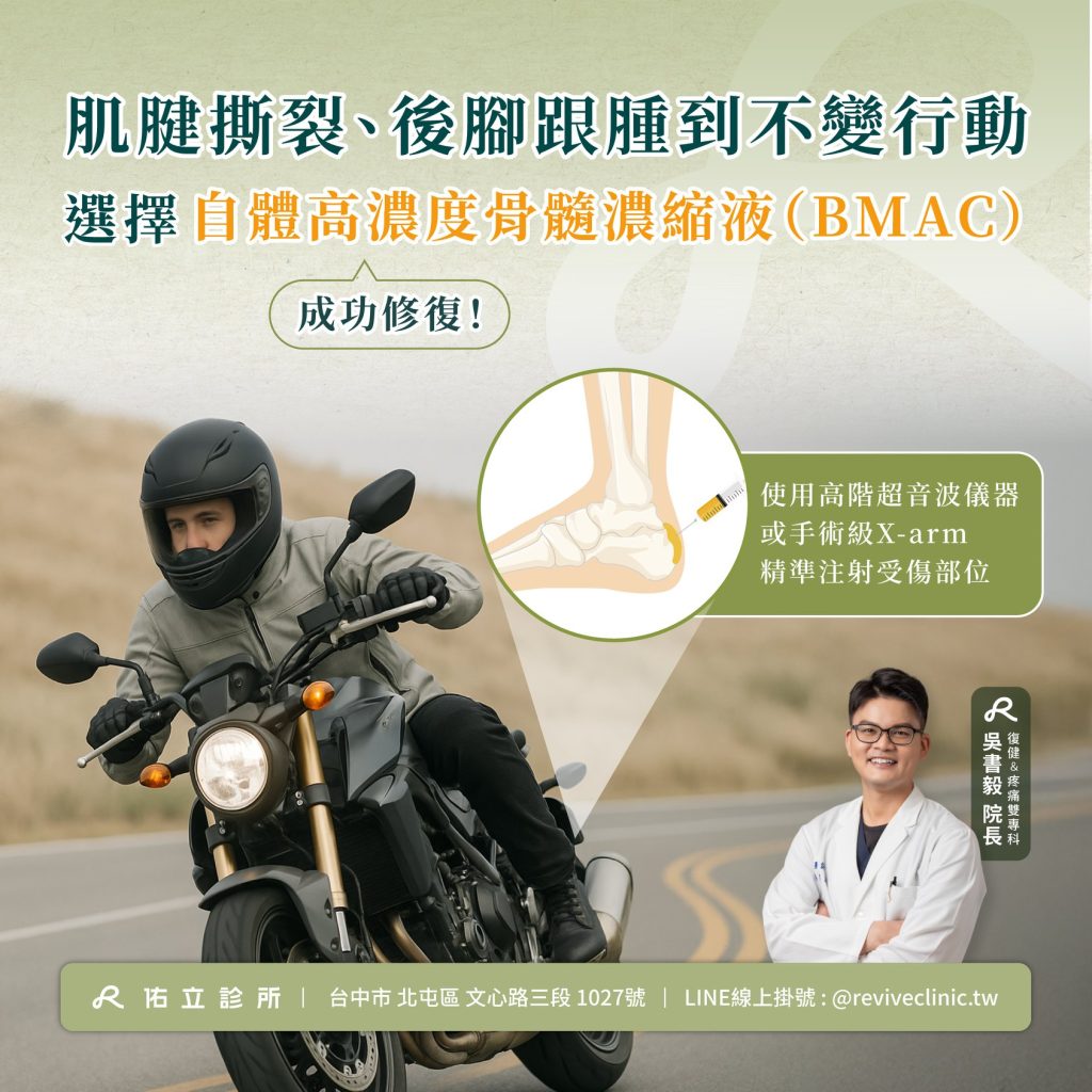 BMAC治療指南：與PRP差異、適用症、流程與治療後照護總覽 - 佑立診所 Revive Clinic